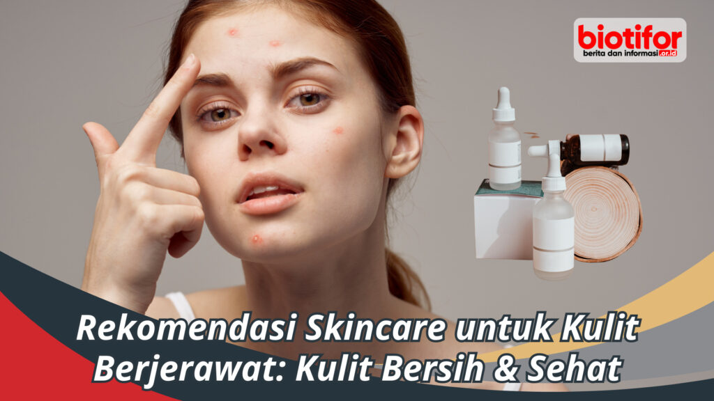 Rekomendasi Skincare untuk Kulit Berjerawat: Kulit Bersih & Sehat - Biotifor