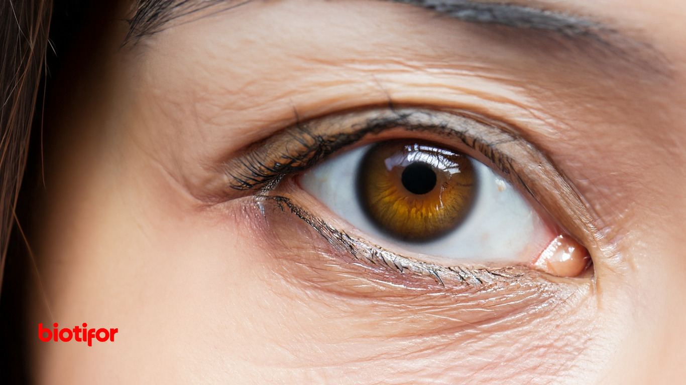 Kedutan Mata Kanan Atas: Mitos dan Fakta - Biotifor