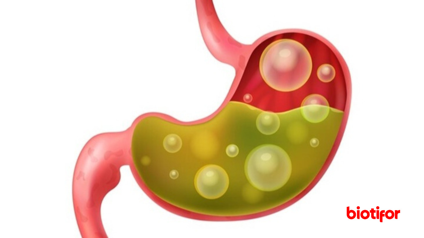 Fungsi Lambung: Pentingnya Organ yang Sering Diabaikan - Biotifor