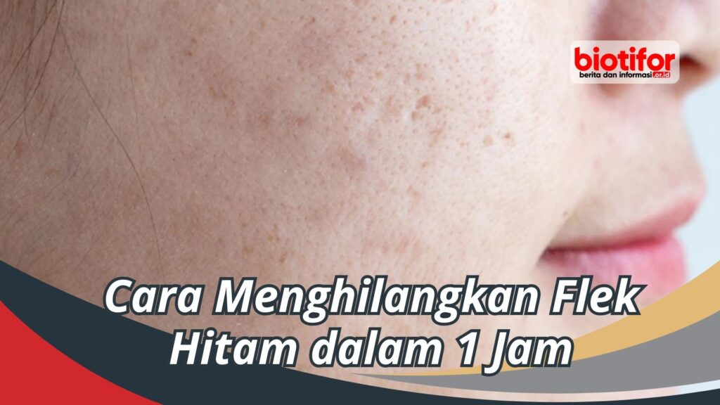 Cara Menghilangkan Flek Hitam dalam 1 Jam - Biotifor