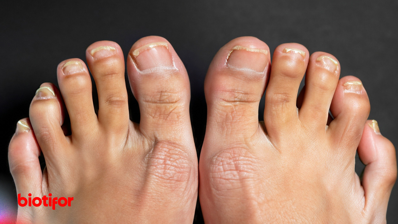 Fungsi Tulang Jari Kaki: Kesehatan dan Keseimbangan Tubuh - Biotifor