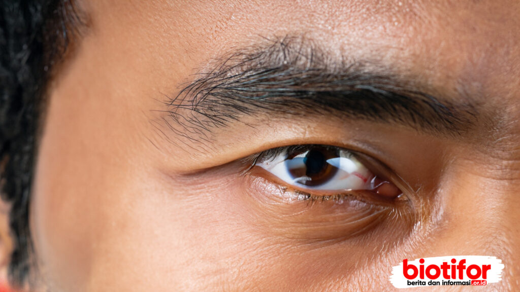 Cara Menjaga Kesehatan Mata Panduan Untuk Mata yang Sehat