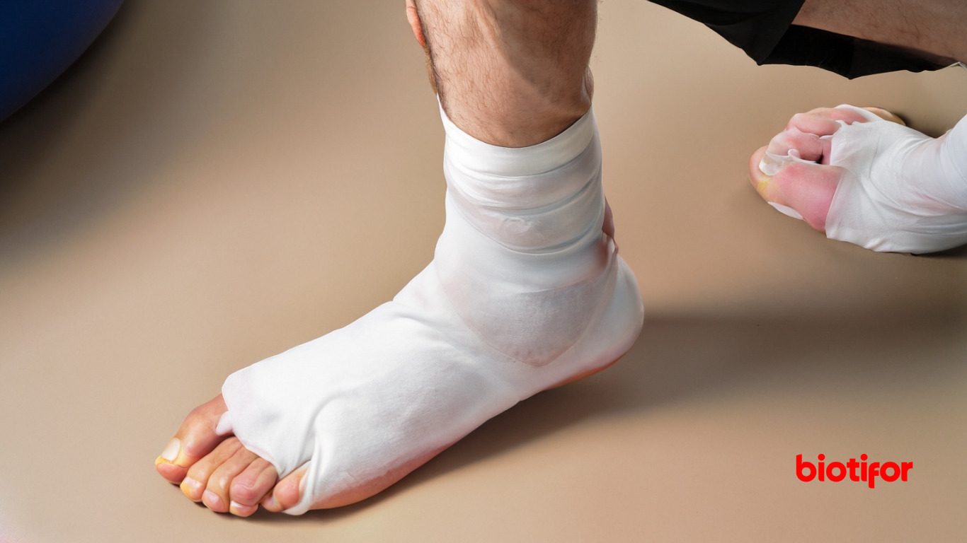 Obat Keseleo: Mengatasi Cedera Sendi dengan Tepat - Biotifor