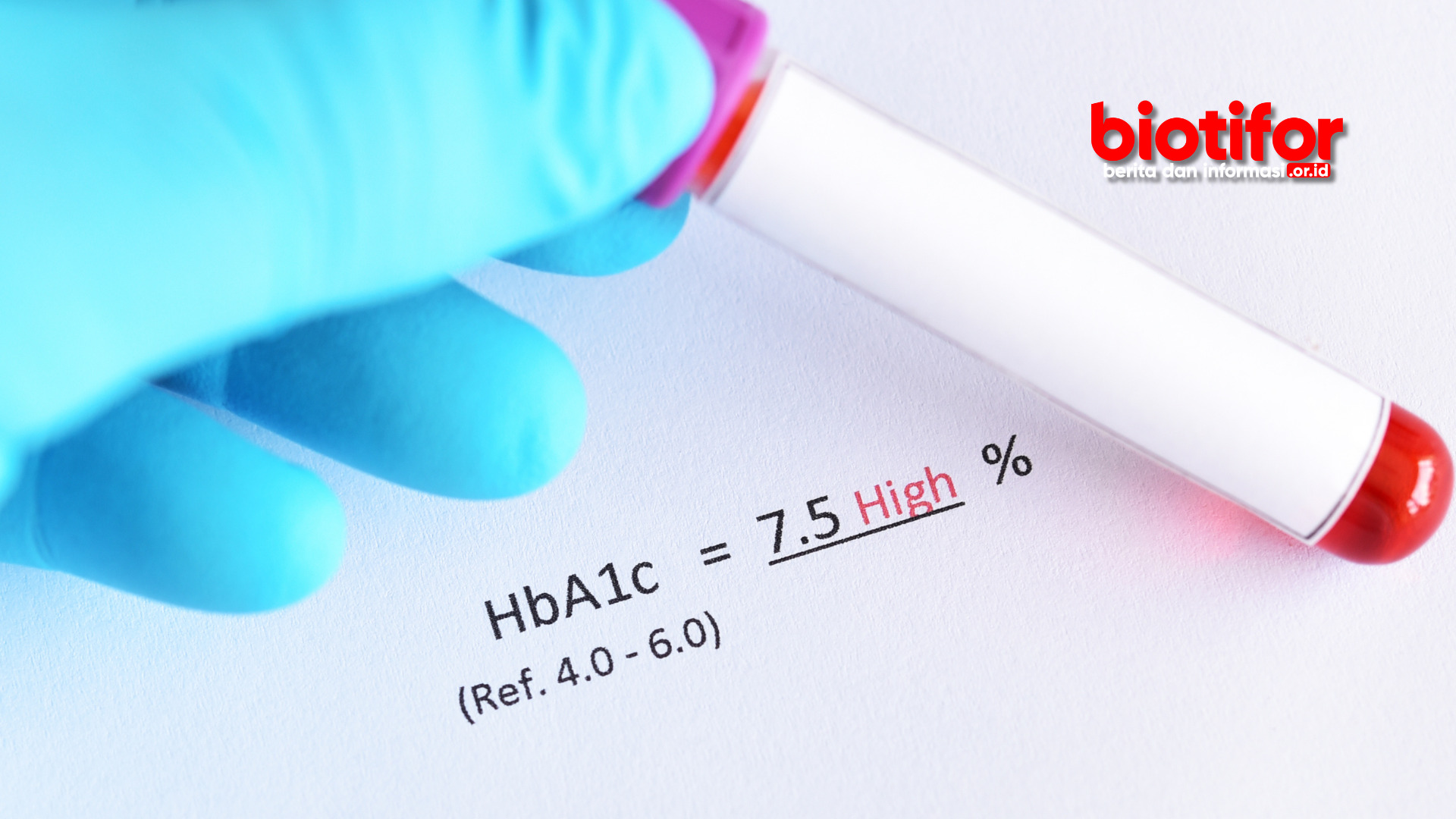 8 Penyebab Hb Tinggi dan Menurunkan Kandungan Hemoglobin - Biotifor