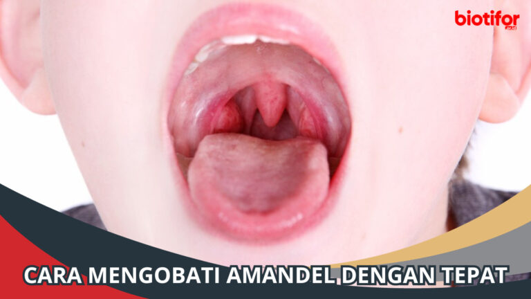 Cara Mengobati Amandel Tanpa Operasi, Terbukti! - Biotifor