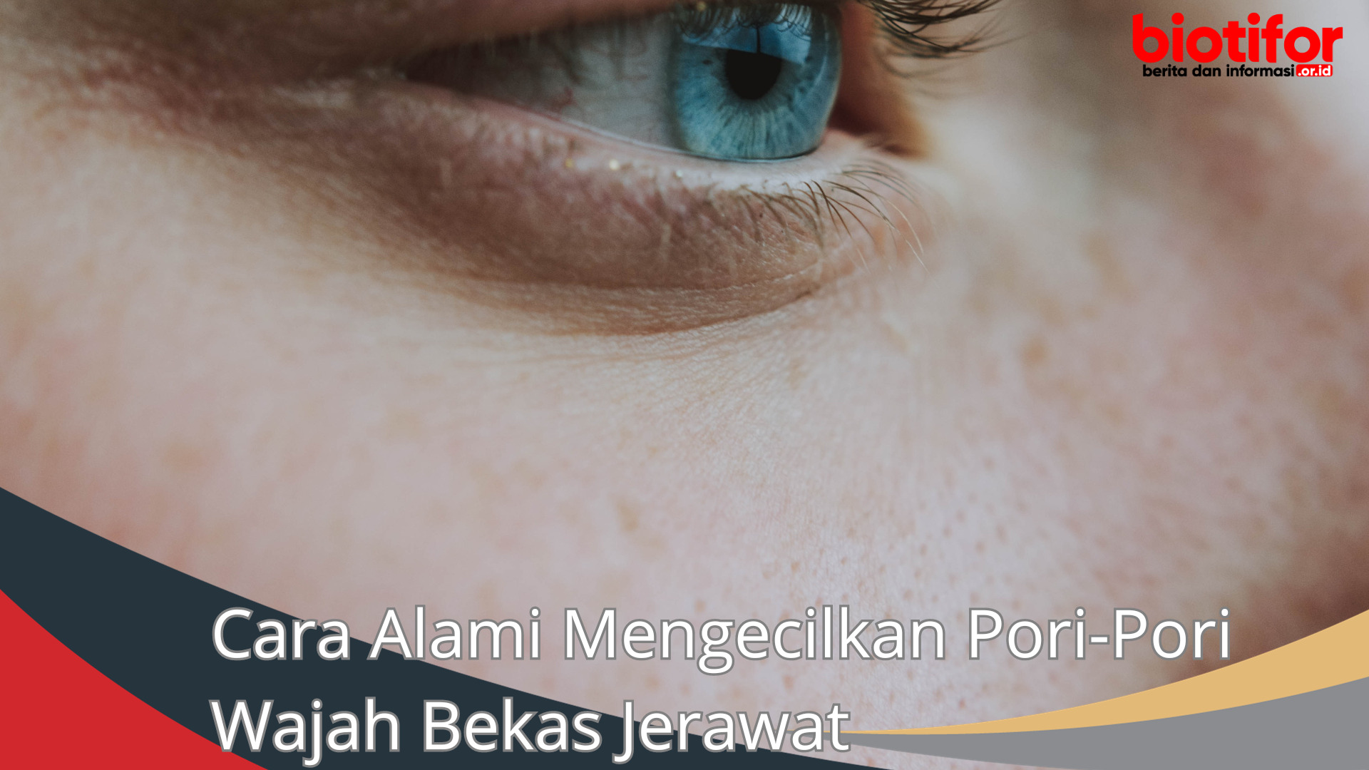 Cara Alami Mengecilkan Pori-Pori Wajah Bekas Jerawat Cara Alami Mengecilkan Pori-Pori Wajah Bekas Jerawat