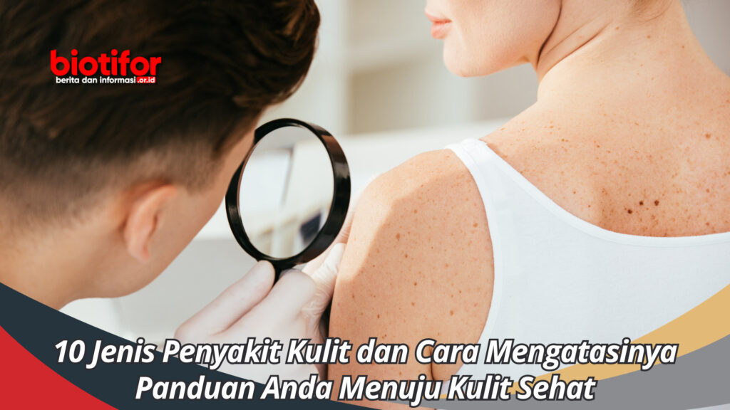 10 Jenis Penyakit Kulit dan Cara Mengatasinya: Panduan Anda Menuju Kulit Sehat - Biotifor