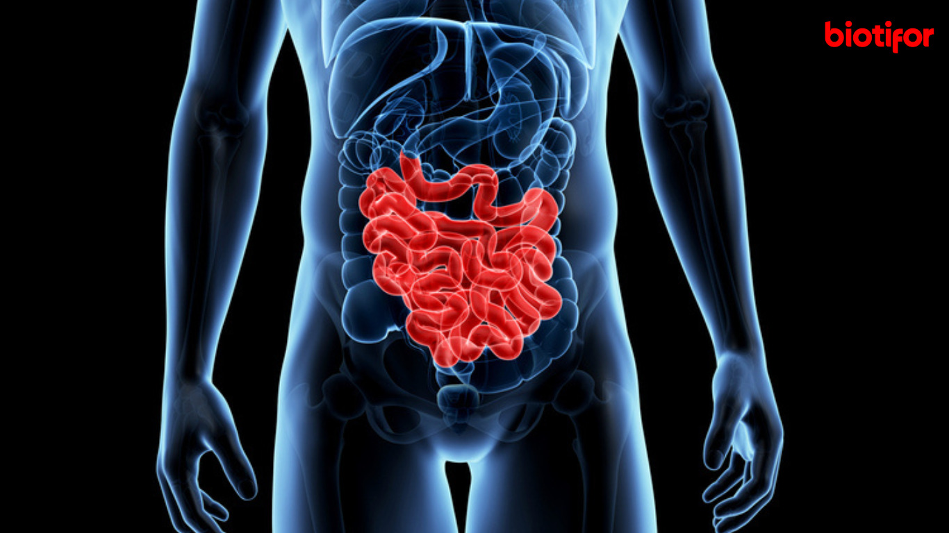 Cara Membersihkan Usus Kotor | Cintai Ususmu dengan Cara ini! - Biotifor