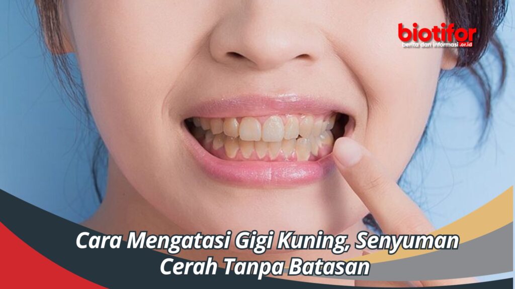 Cara Mengatasi Gigi Kuning, Senyuman Cerah Tanpa Batasan - Biotifor