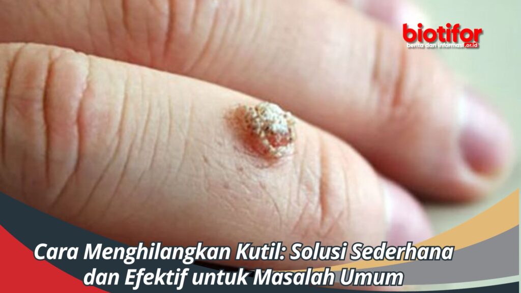 Cara Menghilangkan Kutil: Solusi Sederhana dan Efektif untuk Masalah Umum