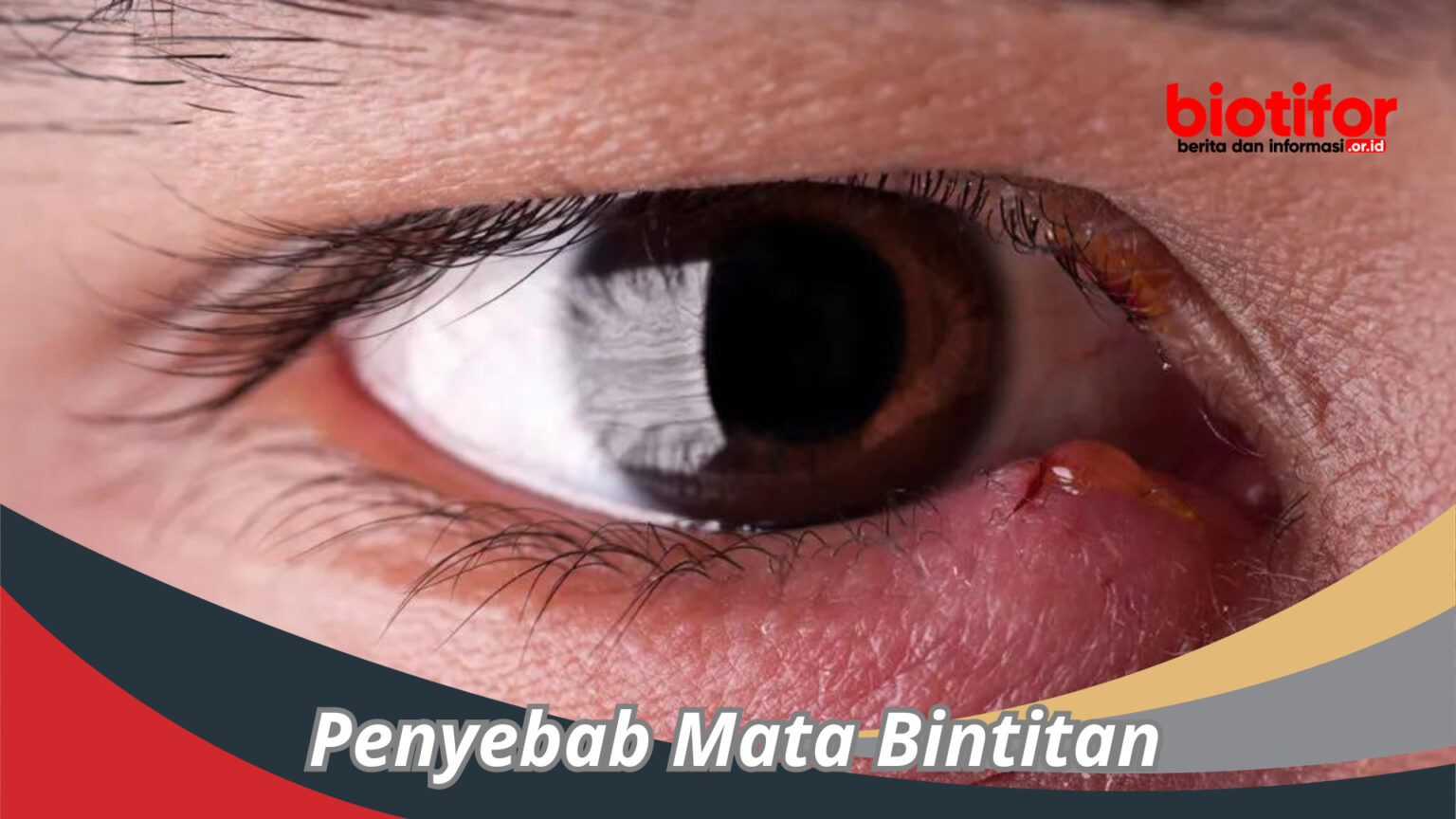 Penyebab Mata Bintitan Yang Jarang Diketahui - Biotifor