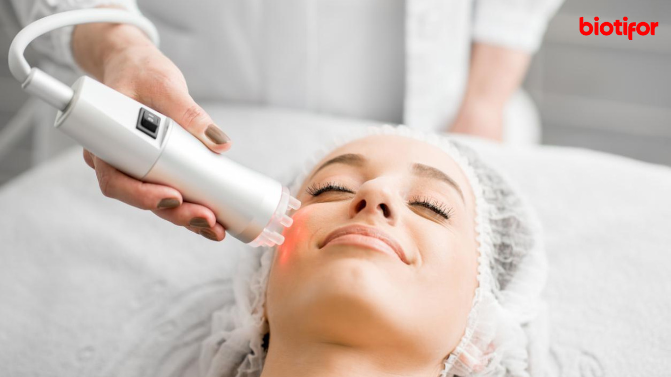 10 Manfaat Laser Wajah: Teknologi Terbaru untuk Kulit Cantik - Biotifor