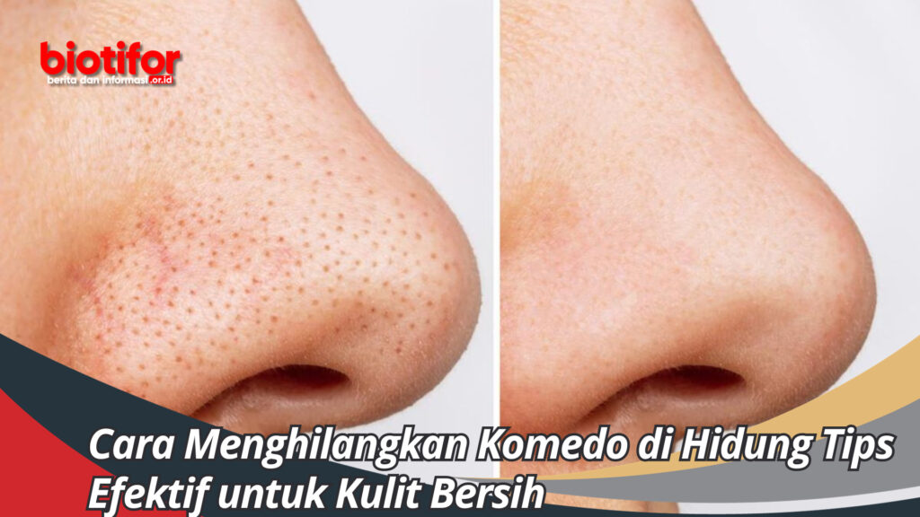 Cara Menghilangkan Komedo di Hidung Tips Efektif untuk Kulit Bersih