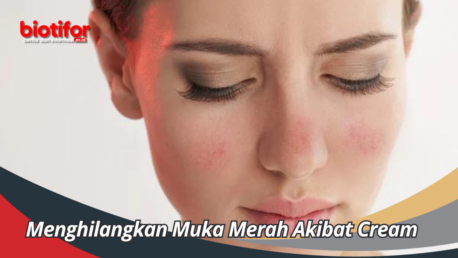 Cara Menghilangkan Muka Merah Akibat Cream Perhatikan Dmpak Dan Cara ...