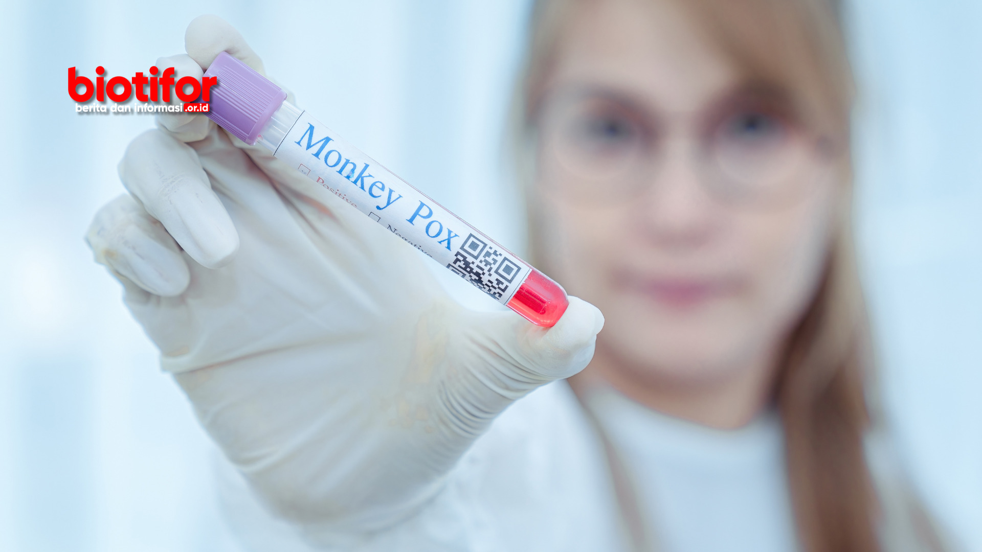 Apa Itu Cacar Monyet? Penyebab, Gejala, Proses Penularan dan ...