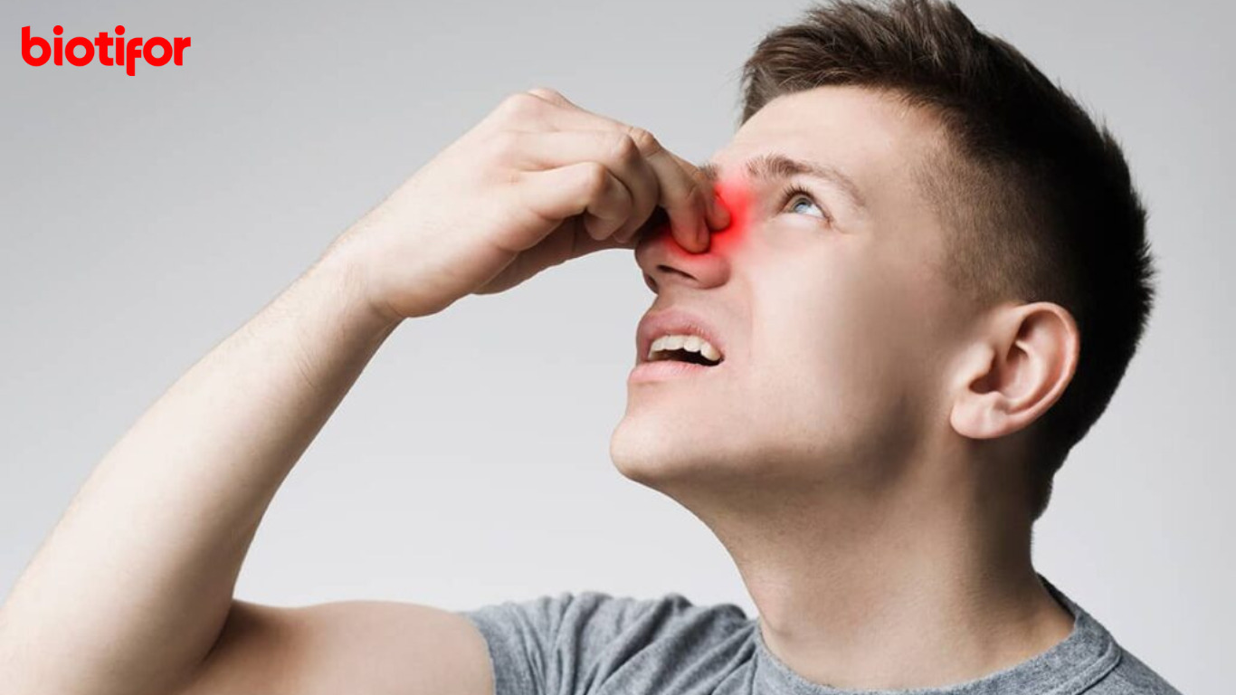 Bahaya Polip Hidung: Penyebab, Tanda, Gejala, dan Pengobatan - Biotifor