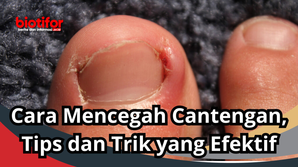 Cara Mencegah Cantengan, Tips dan Trik yang Efektif - Biotifor