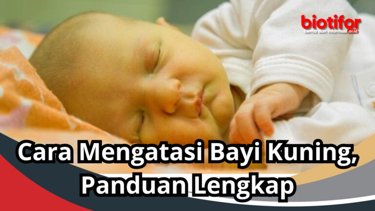 Cara Mengatasi Bayi Kuning, Panduan Lengkap - Biotifor