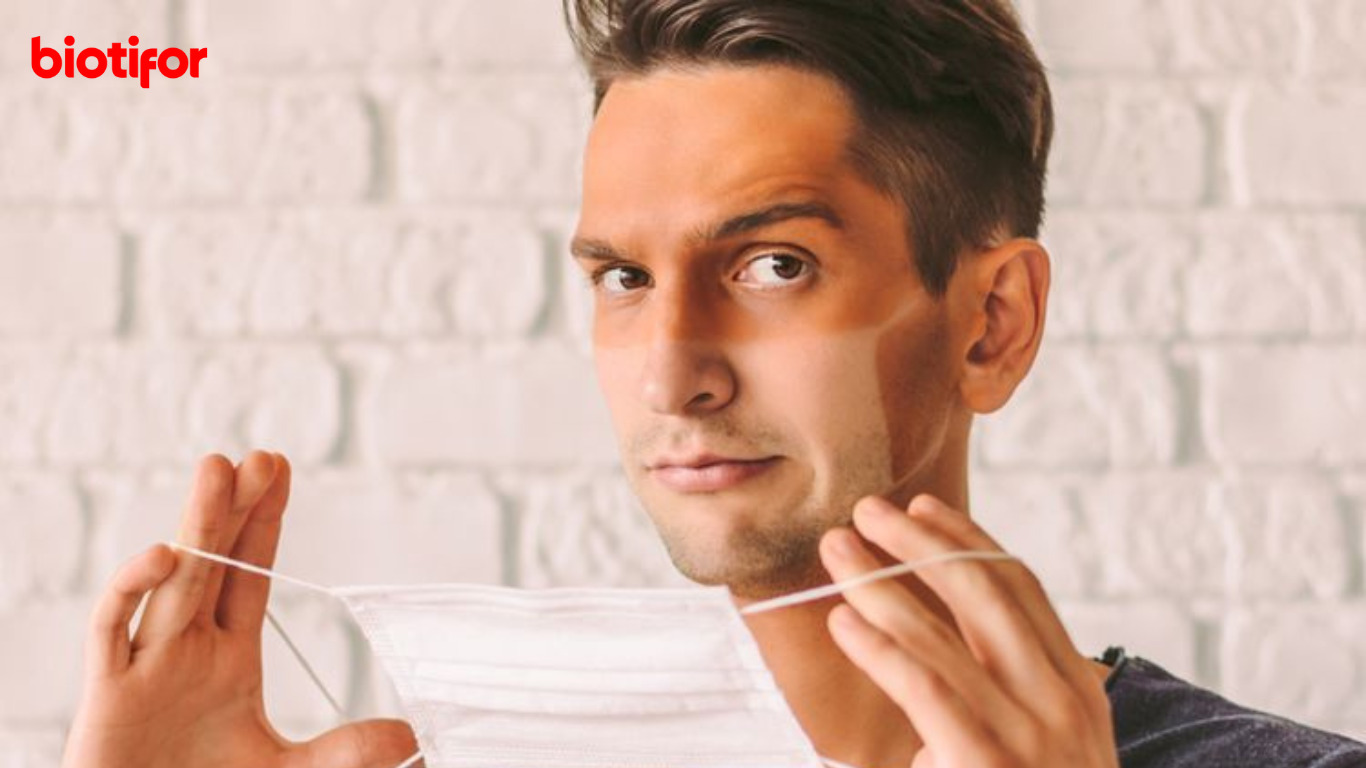 Cara Mengatasi Kulit Belang dengan Mudah - Biotifor