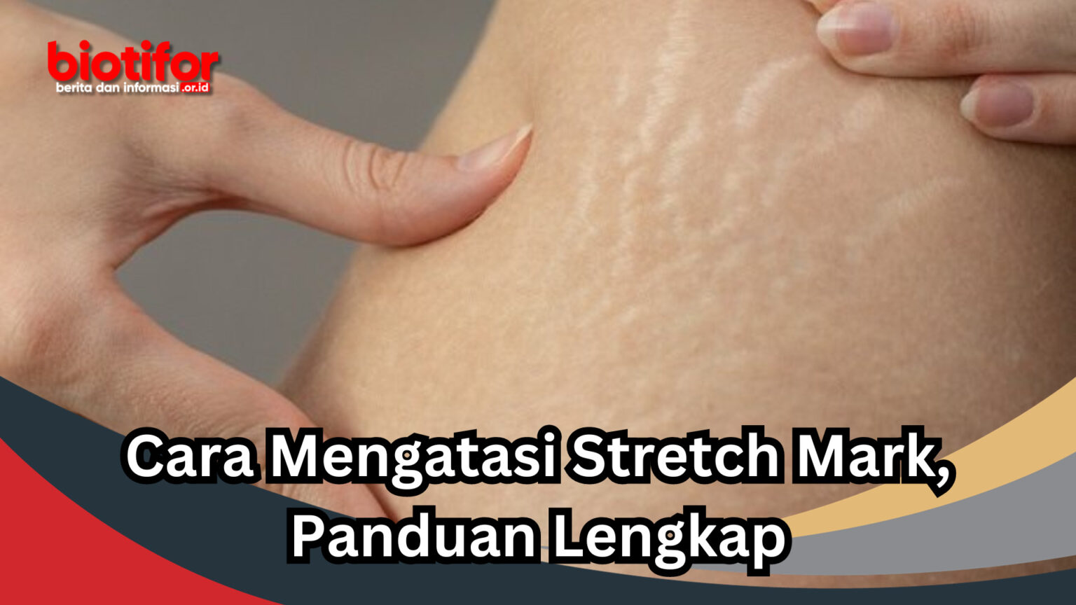 Cara Mengatasi Stretch Mark, Panduan Lengkap - Biotifor