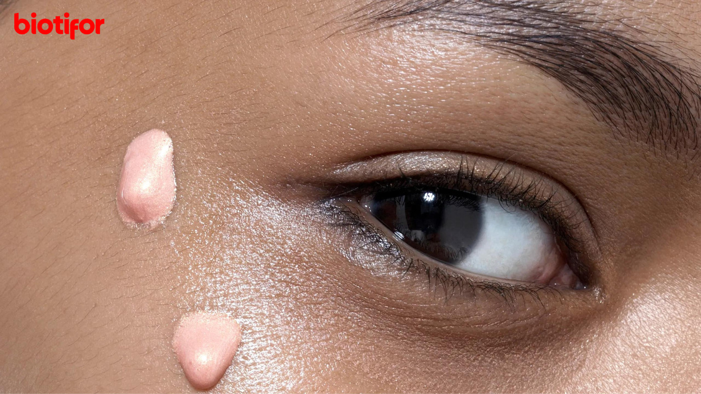 Cara Menggunakan Benzoyl Peroxide untuk Kulit Bebas Jerawat - Biotifor