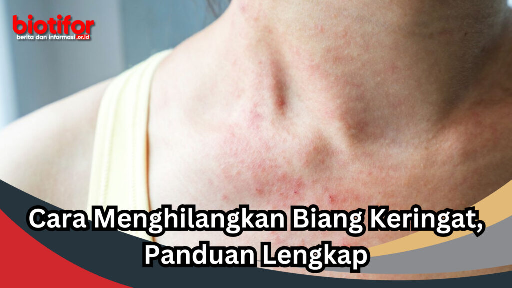 Cara Menghilangkan Biang Keringat, Panduan Lengkap - Biotifor