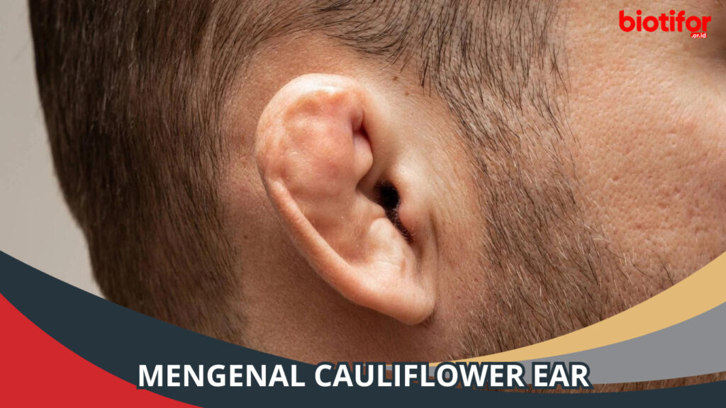 Cauliflower Ear: Penyebab, Pengobatan, dan Cara Mencegah - Biotifor