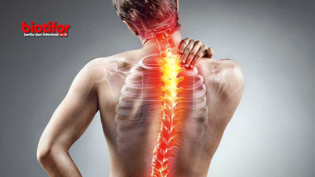 Mengenal Penyakit HNP (Hernia Nukleus Pulposus), Penyebab, Gejala ...