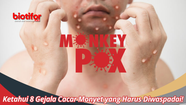 Ketahui 8 Gejala Cacar Monyet yang Harus Diwaspadai! - Biotifor