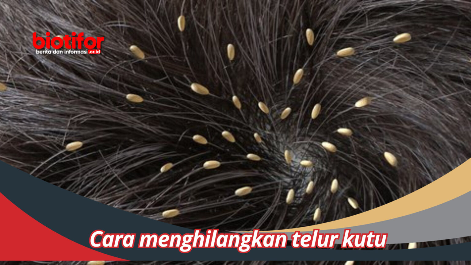 Cara menghilangkan telur kutu Dengan Mudah Dan Efektif